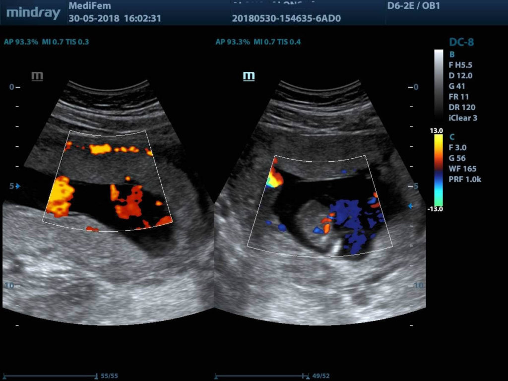ECOGRAFÍA DOPPLER – Centro del Diagnóstico